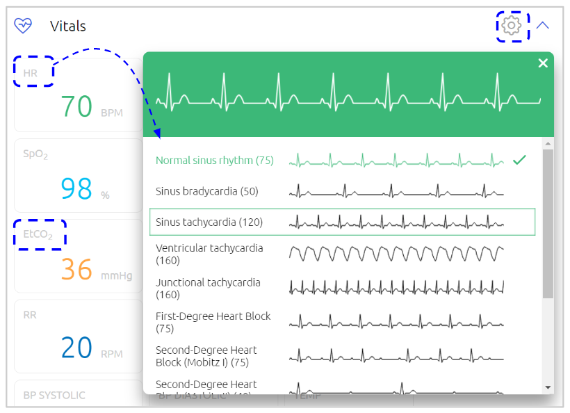 Capnogram, EtCO2, and New ECG Waveforms | PCS
